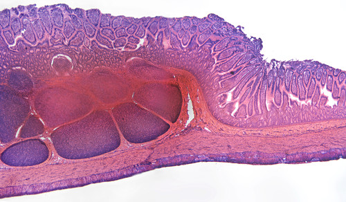 Ileum Bilder Science Photo Library