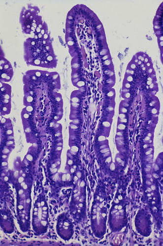 Ileum Bilder Science Photo Library