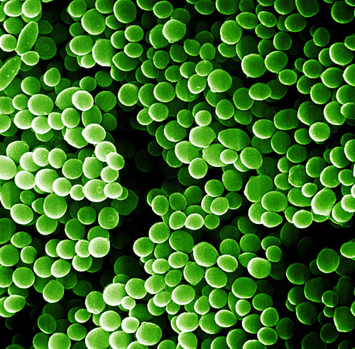 Staphylocoque doré Photos Science Photo Library
