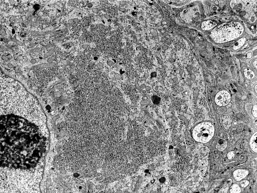 Neuron Bilder Science Photo Library