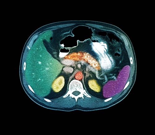 Pankreas Bilder Science Photo Library