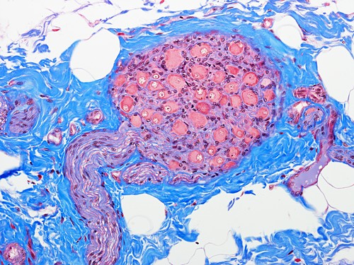 Ganglion Bilder Science Photo Library