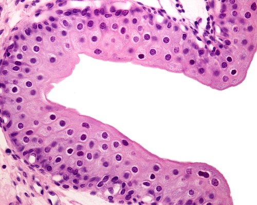 Épithélium de transition Photos Science Photo Library