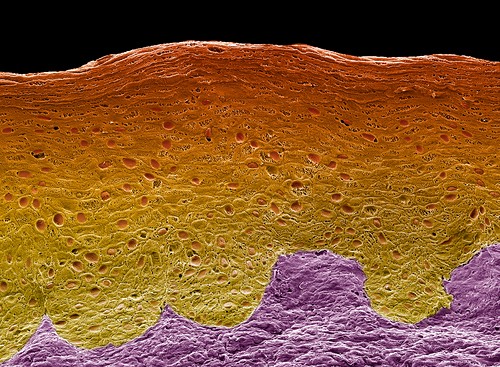 Vagina Bilder Science Photo Library