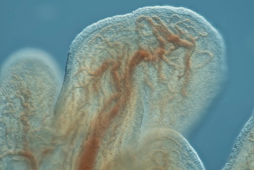 Trompe de Fallope Photos Science Photo Library