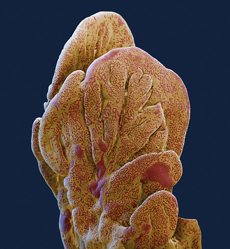 Trompe de Fallope Photos Science Photo Library