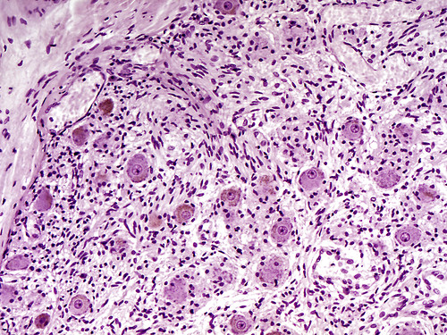 Ganglion Bilder Science Photo Library