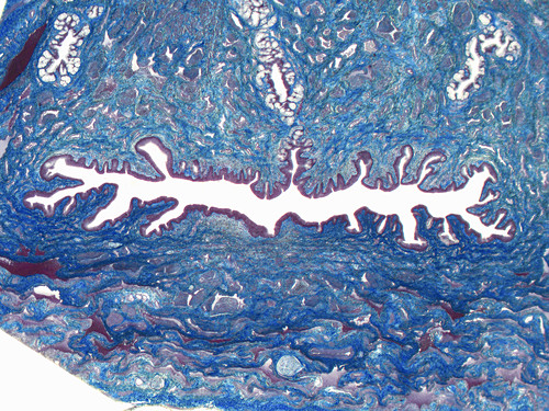 Urethra Bilder Science Photo Library