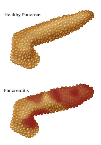 Pankreas Bilder Science Photo Library