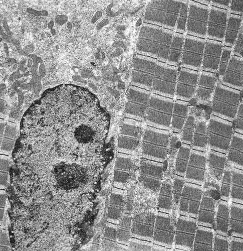 Tem Bilder Science Photo Library