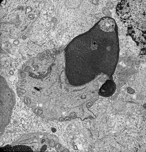 Testicules Photos Science Photo Library